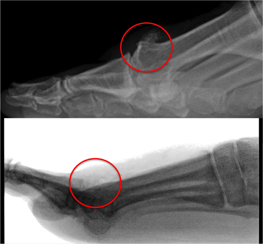 Minimally Invasive Surgery - Christopher Miller